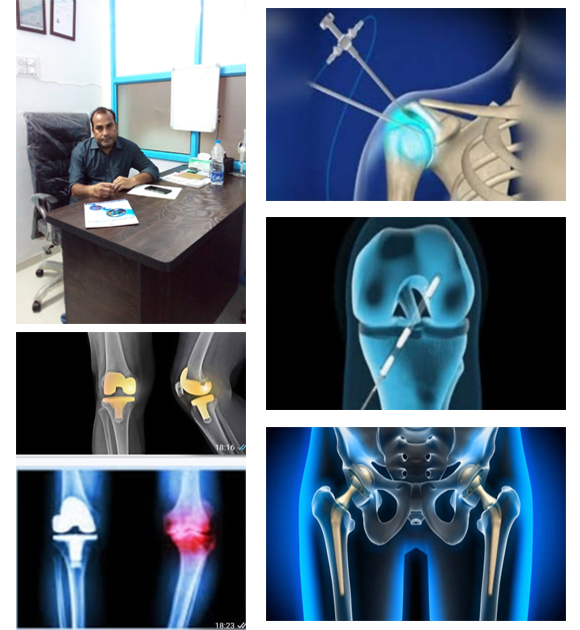 Aarvi Advanced Orthopaedic Clinic (Dr. Prof. Arvind Kumar), Vadodara ...